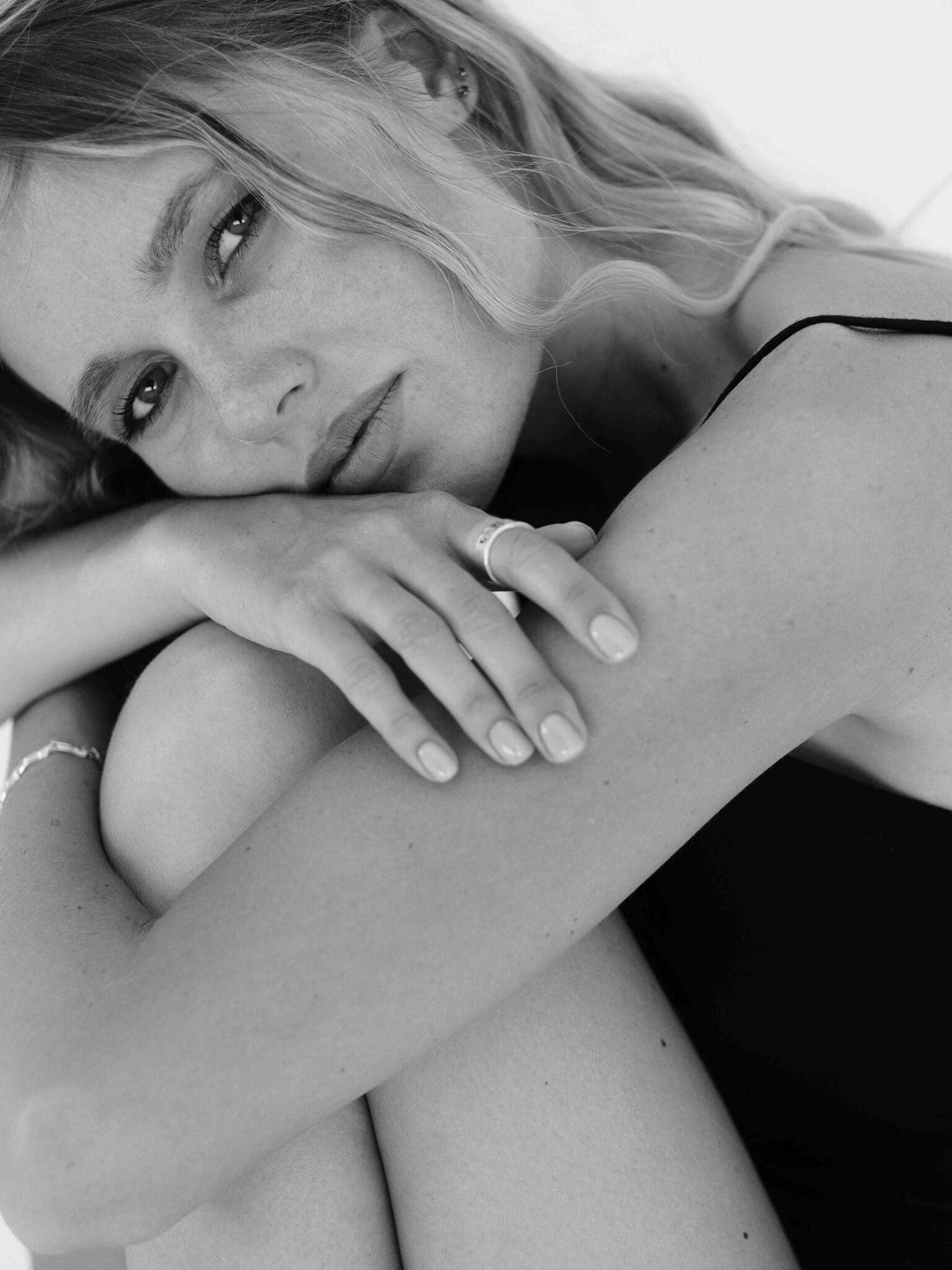 BBL Hero Laser Treatment in St. Louis, MO | Broad Band Light